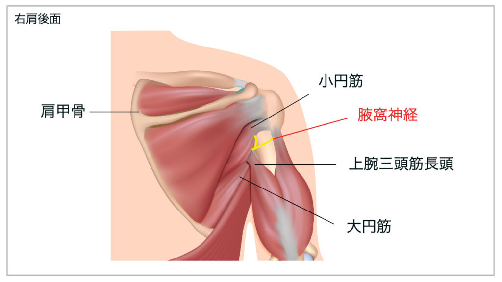 肩QLS症候群とリハビリテーション