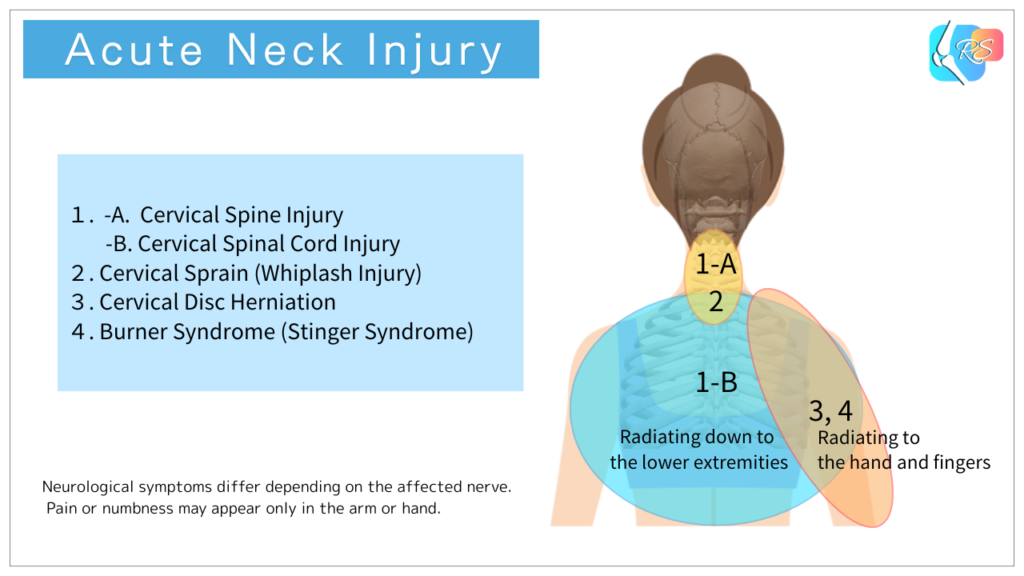 Neck Injuries in Sports: Causes, Acute Trauma, and Chronic Conditions