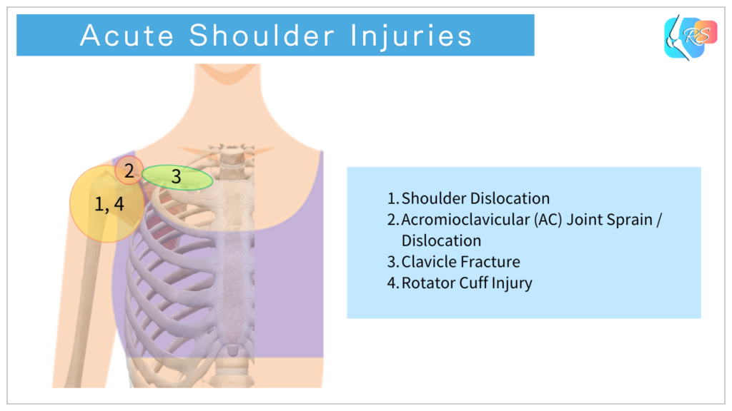 Shoulder Pain and Injuries: Common Causes in Sports and Daily Life